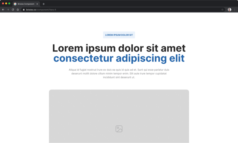 The Missing Piece in your Bricks Builder Workflow | Brixies